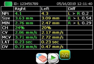 NeurOptics | NPi-200 Pupillometer