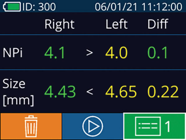 NPi®-300 Pupillometer Resources - NeurOptics