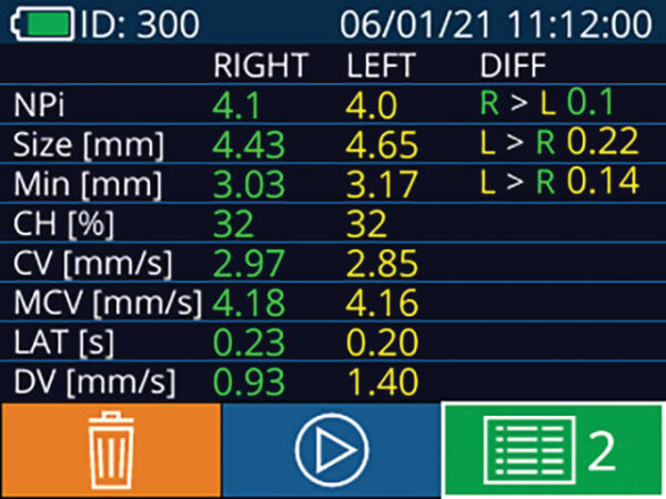 NPi®-300 Pupillometer Resources - NeurOptics