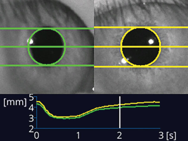 NPi®-300 Pupillometer Resources - NeurOptics