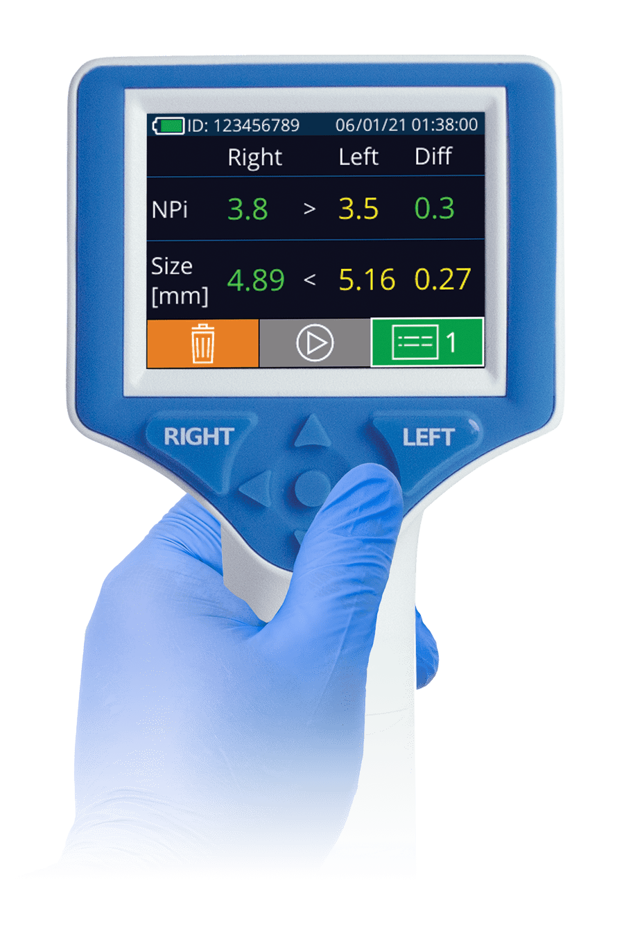 The Smart Approach to Pupillary Evaluation - NeurOptics