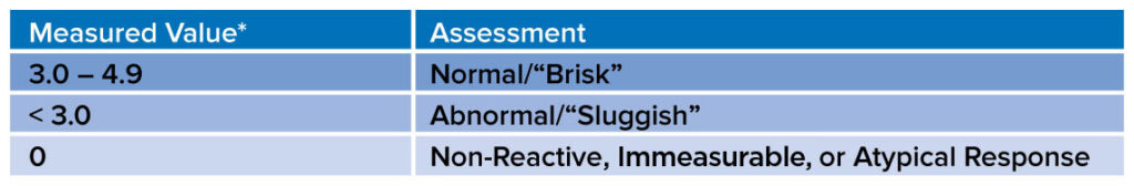 NeurOptics | Measure Pupil Reactivity with NPi-200 Pupillometer