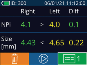 Measure Pupil Size with NPi-300 Pupillometer - NeurOptics