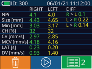 Measure Pupil Size with NPi-300 Pupillometer - NeurOptics