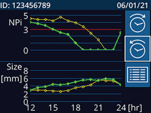 Measure Pupil Size with NPi-300 Pupillometer - NeurOptics